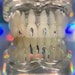 Vamp Fang DIY Tooth Gem Kit | Swarovski Gems | Assorted Flatback Tooth ...