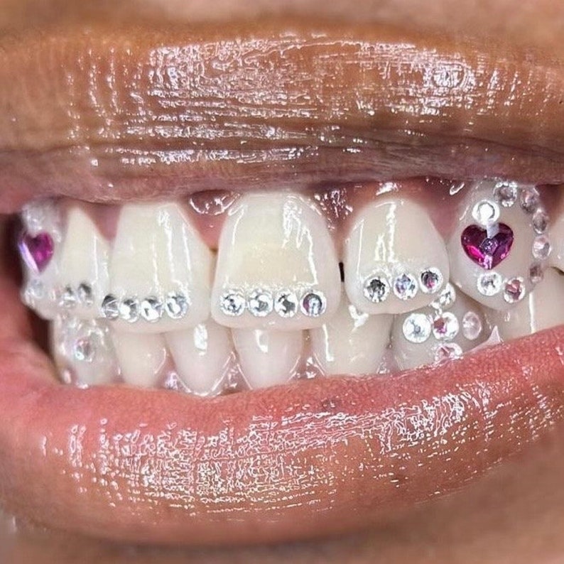 Heart Braces DIY Tooth Gem Kit | Swarovski Gems | Assorted Flatback ...