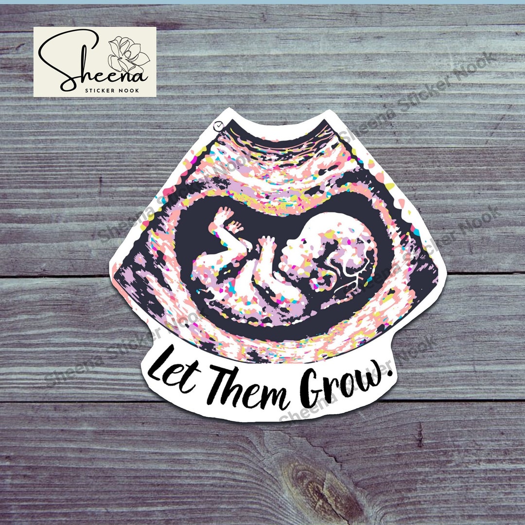Prolife Ultrasound Sticker Let Them Grow Sticker, Pro-life Sticker ...