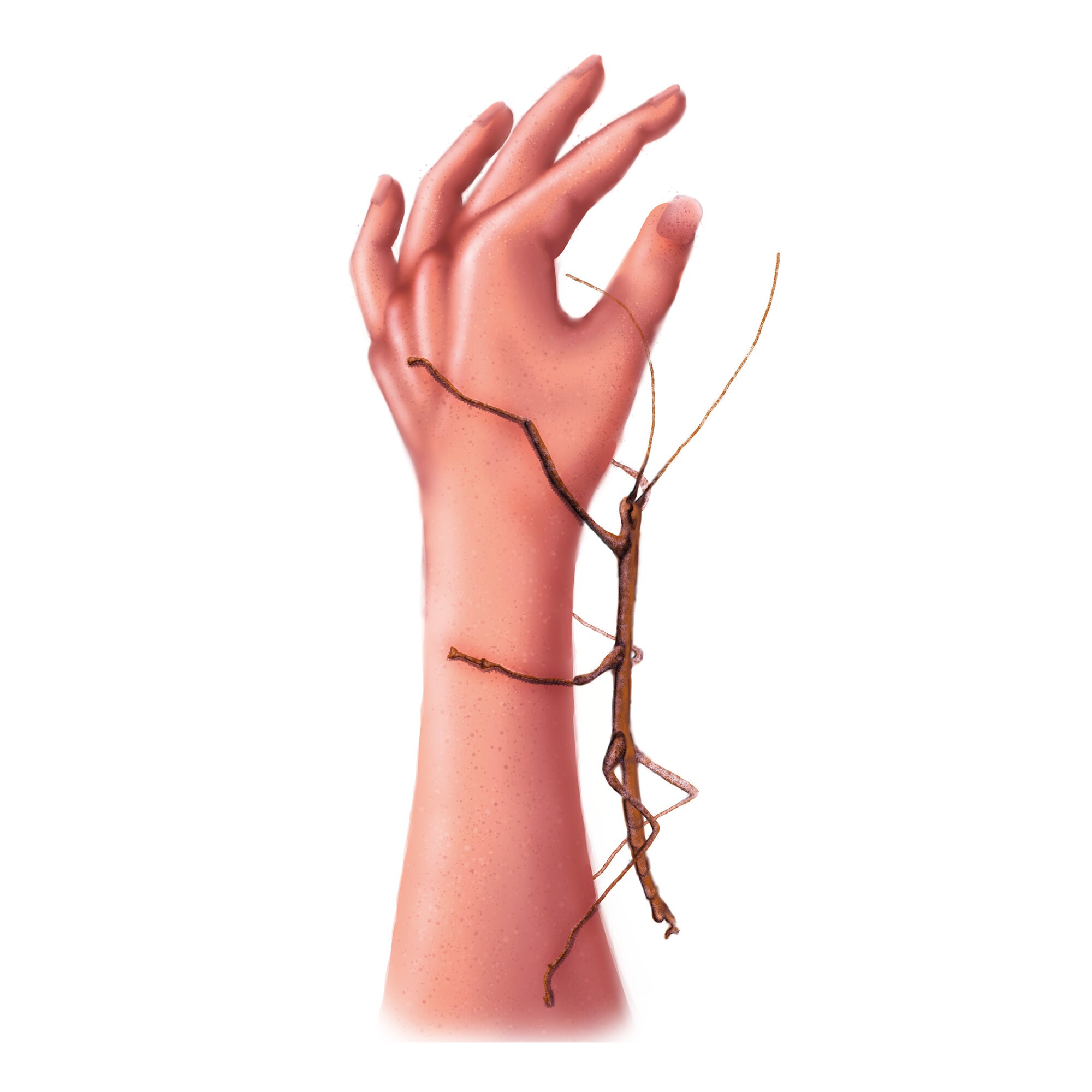 Illustrated Poster Insect and Human Body phasmatodea - Etsy