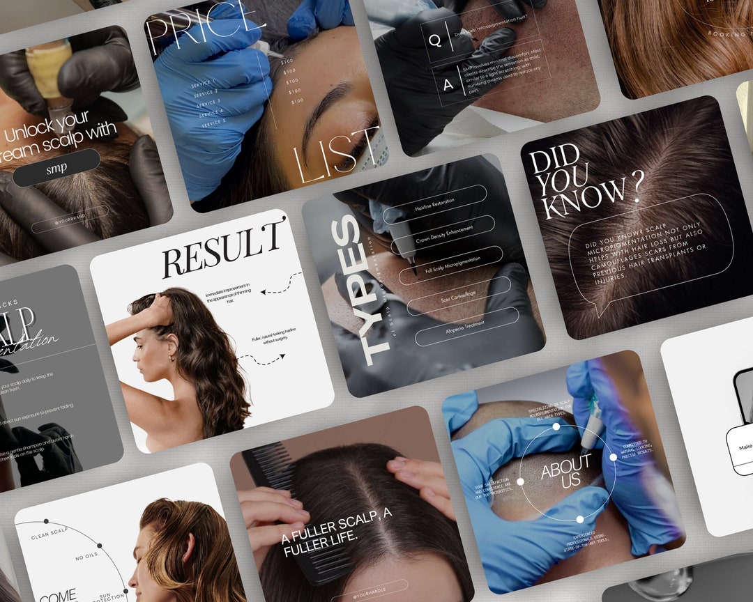 Scalp Micropigmentation Instagram Post Templates, PMU and SMP Social ...