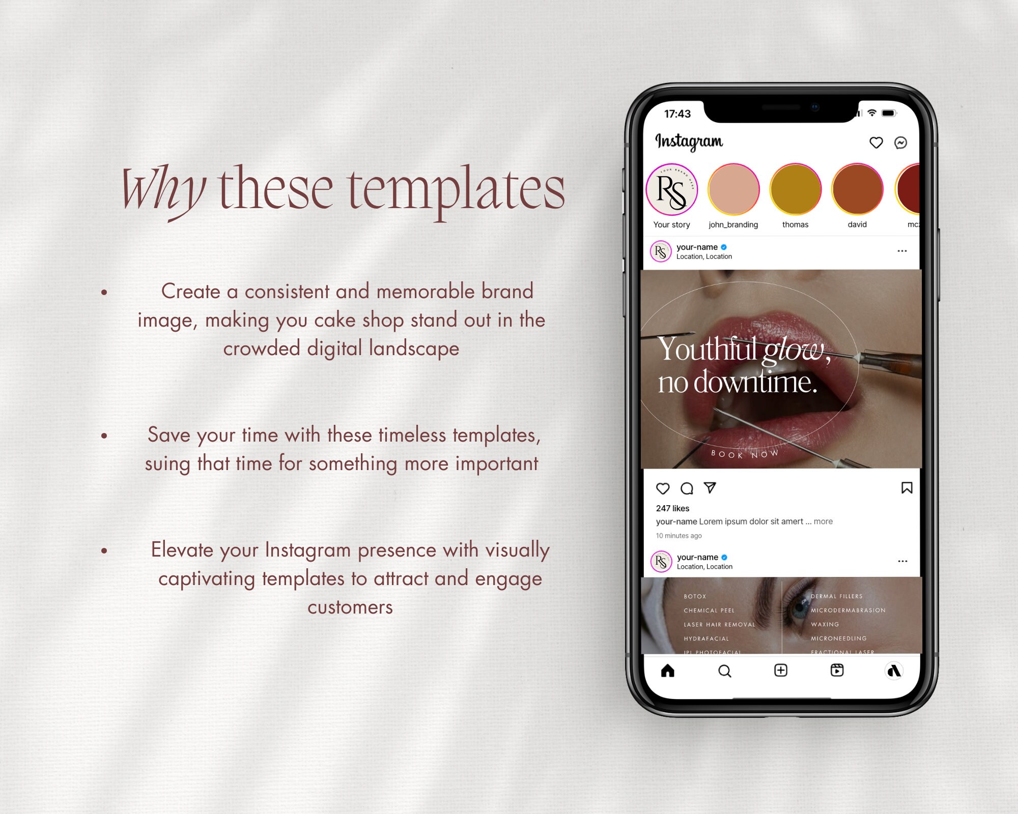 Medspa Instagram Templates, Botox Filler Posts (canva) - Etsy