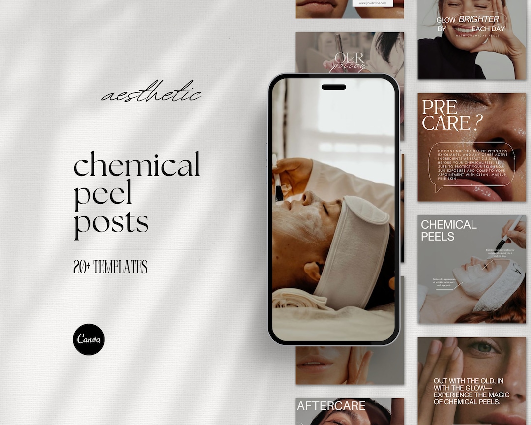 Chemical Peel Instagram Post Templates, Esthetician Posts, Skincare ...