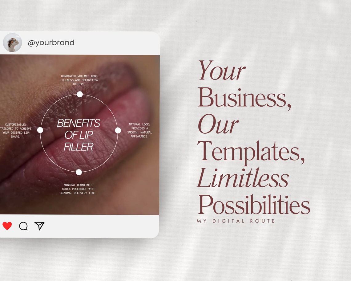 Lip Filler Instagram Reels Templates, Medspa Social Media (canva) - Etsy