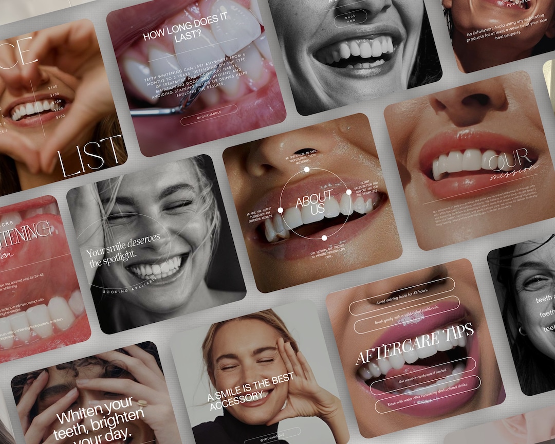 Teeth Whitening Instagram Post Templates, Canva Dentist Flyer Template ...