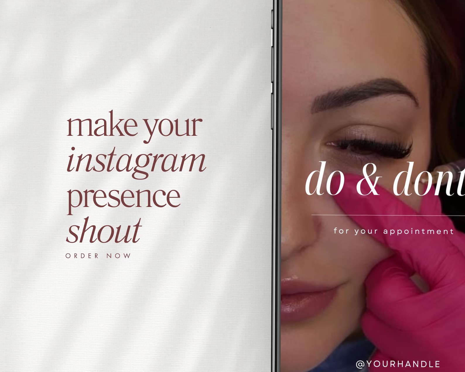 Lip Filler & Botox Instagram Reels, Before and After Reels, Medspa ...