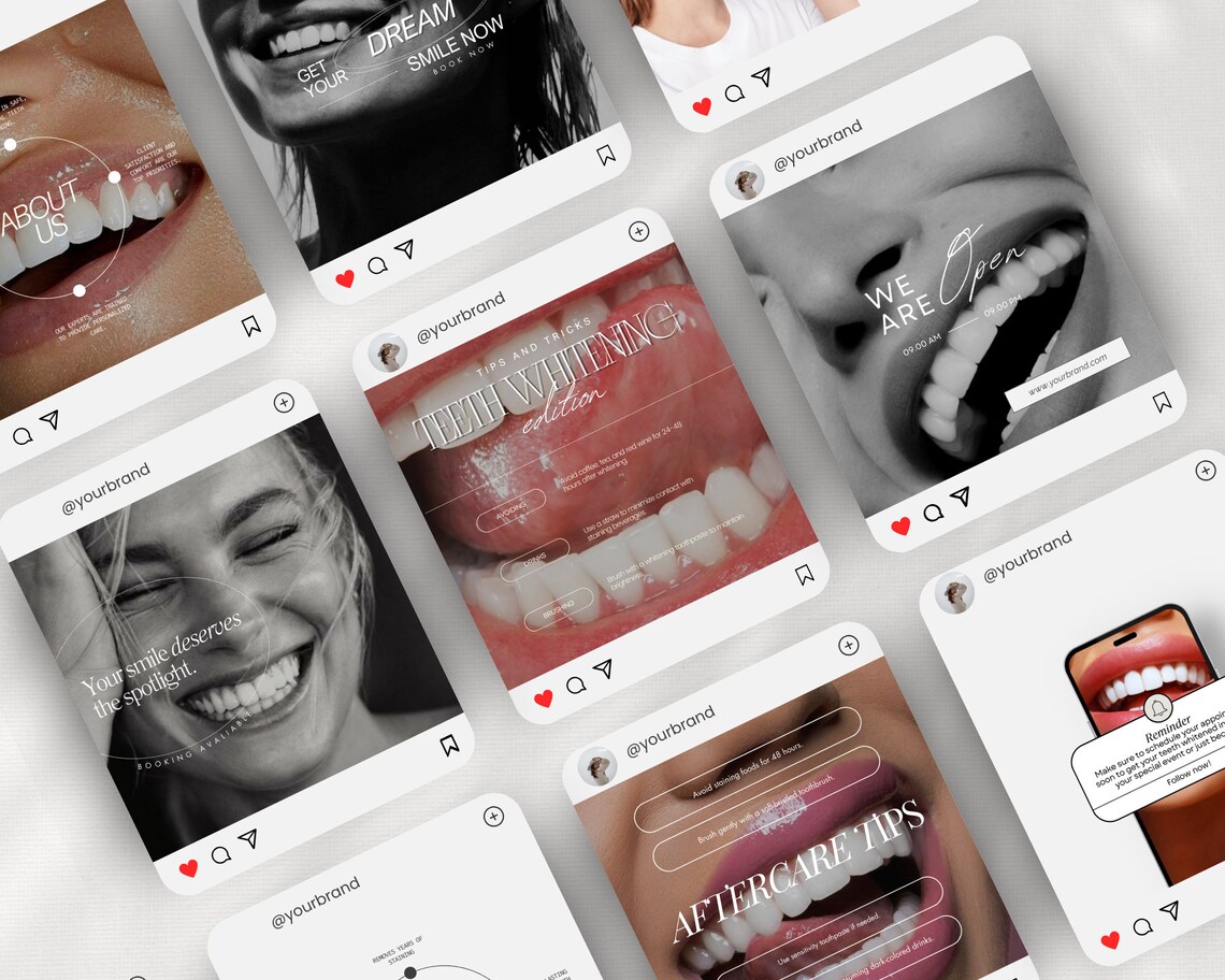 Teeth Whitening Instagram Post Templates, Canva Dentist Flyer Template ...