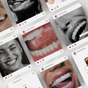 Teeth Whitening Instagram Post Templates, Canva Dentist Flyer Template ...