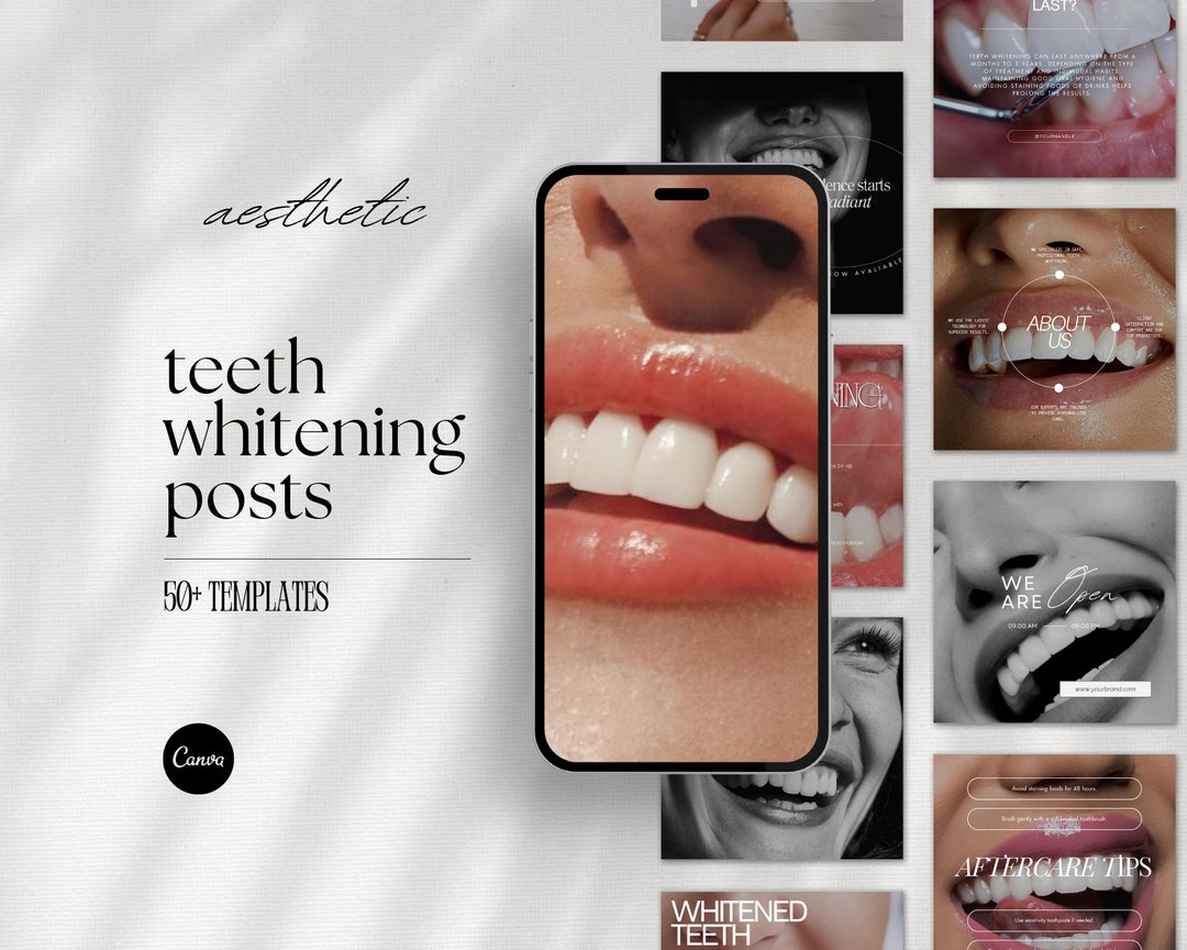 Teeth Whitening Instagram Post Templates, Canva Dentist Flyer Template ...