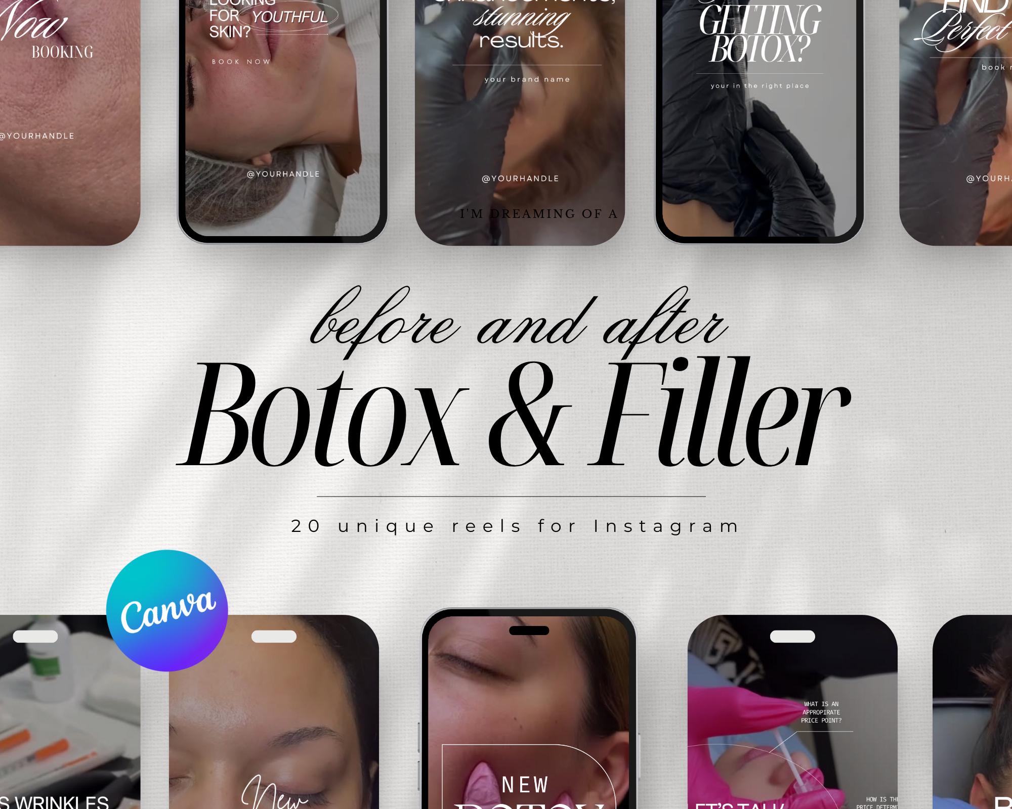Lip Filler & Botox Instagram Reels, Before and After Reels, Medspa ...