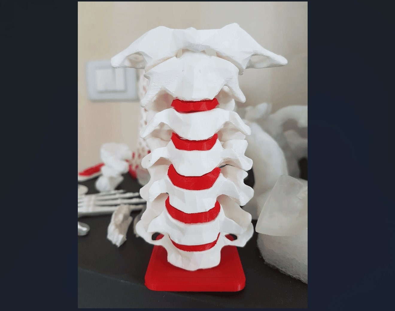 Cervical Vertebrae Model Study Tool - Etsy