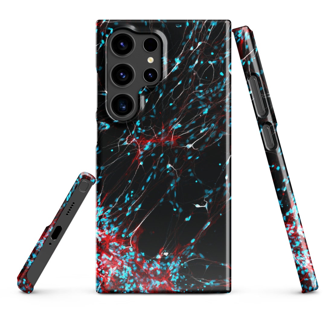 Stemcellgallaxy Unique Cell Microscopy Image Snap Case for Samsung® - Etsy