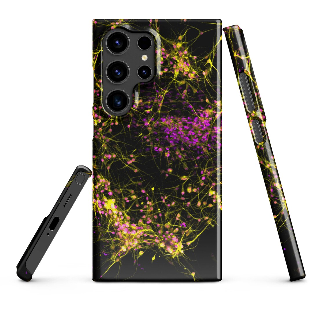 Stemcellgallaxy Unique Cell Microscopy Image Snap Case for Samsung® - Etsy
