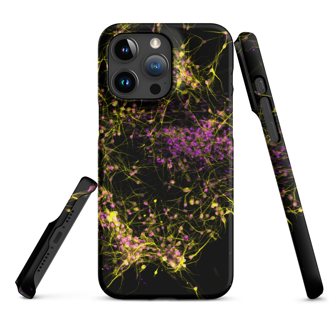 Stemcellgallaxy Unique Cell Microscopy Image Snap Case for Iphone® - Etsy