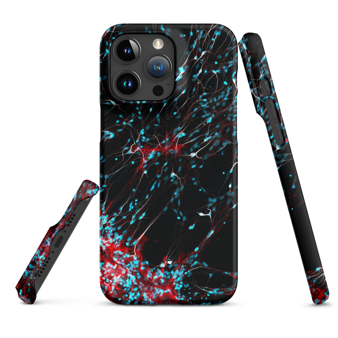 Stemcellgallaxy Unique Cell Microscopy Image Snap Case for Iphone® - Etsy