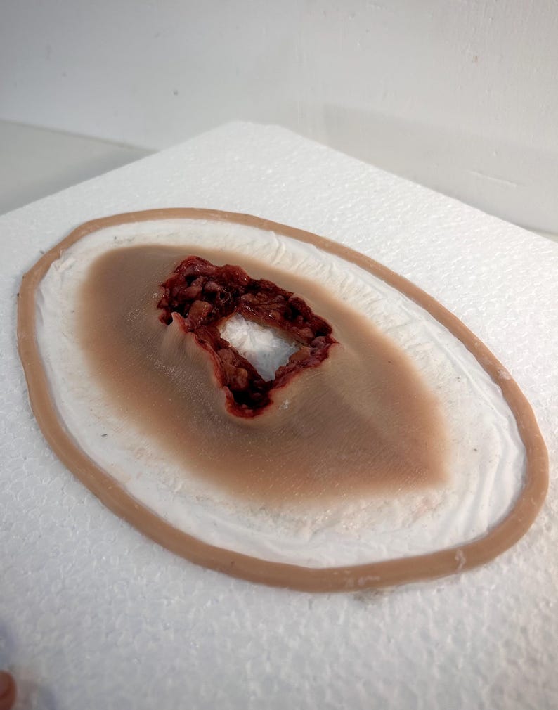 Silicone Open Femur Fracture Prosthetic – Exposed Bone FX Wound ...