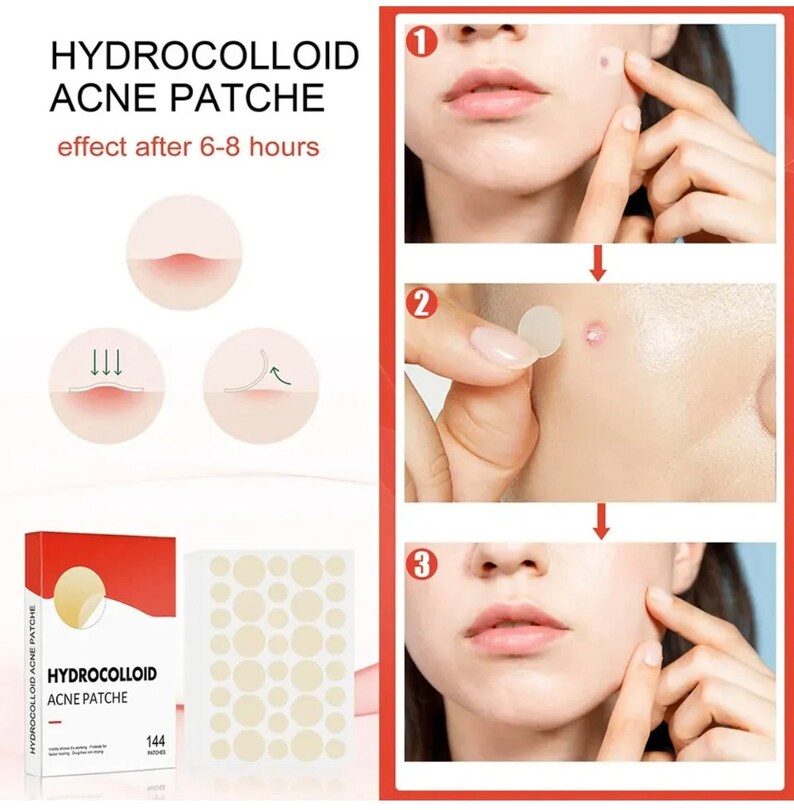 Acne Patch Tag Hydrocolloid Pimple Spot Acne Patch Plaster 144 in A ...