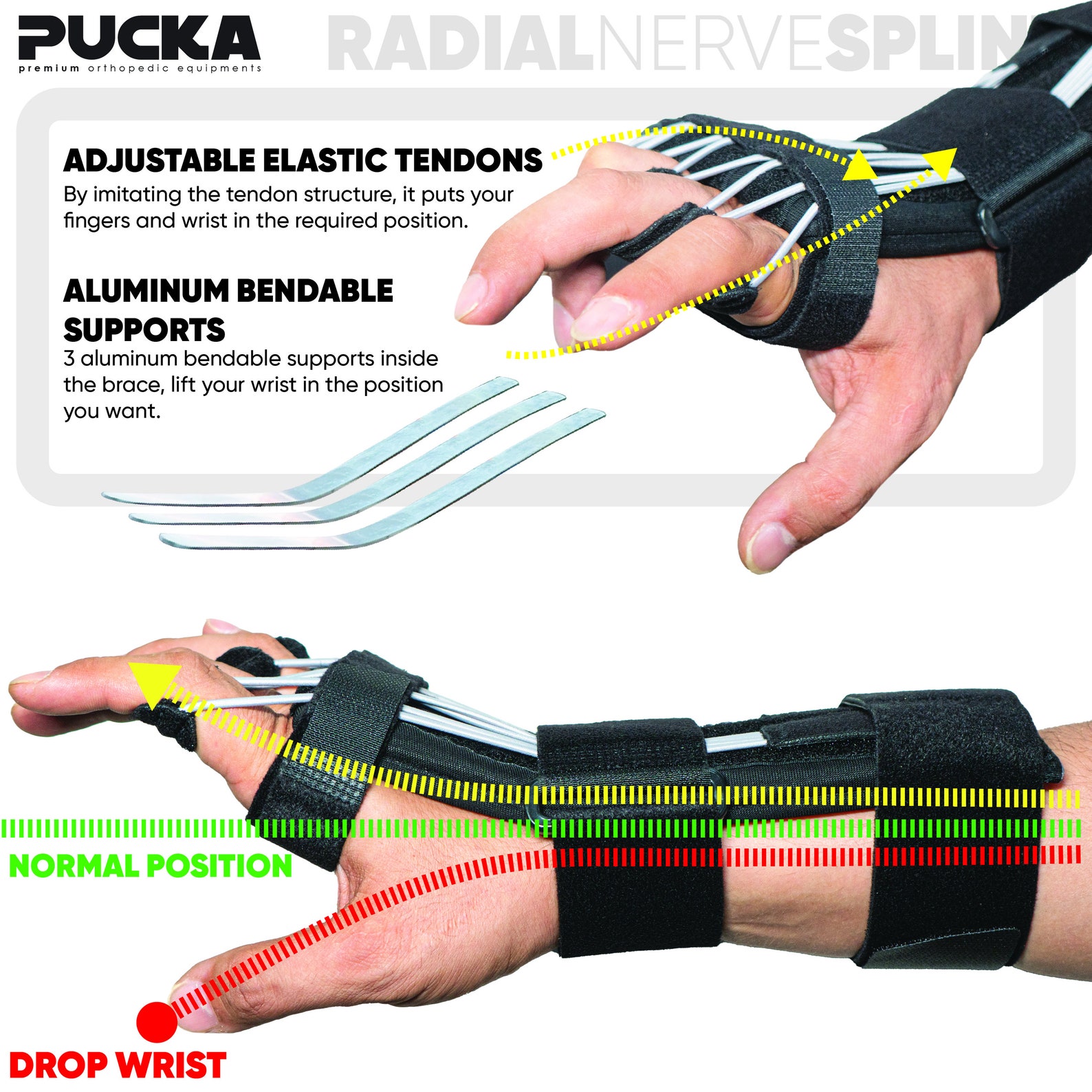 Radial Nerve Palsy Splint Adjustable Dynamic Drop Wrist and Finger ...