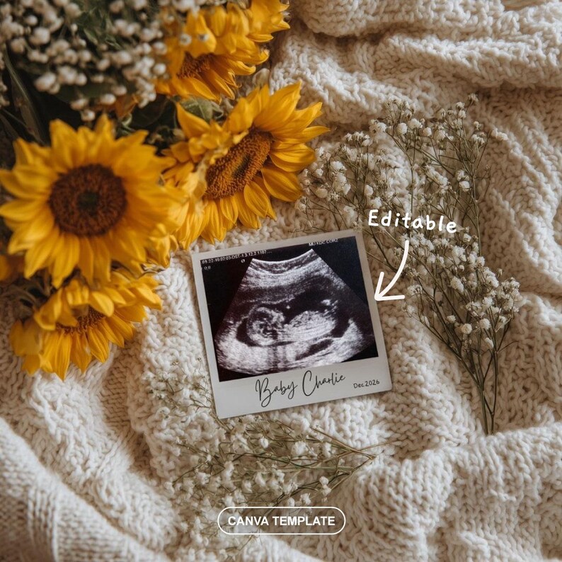 Editable Ultrasound Photo Pregnancy Announcement | Canva Template ...