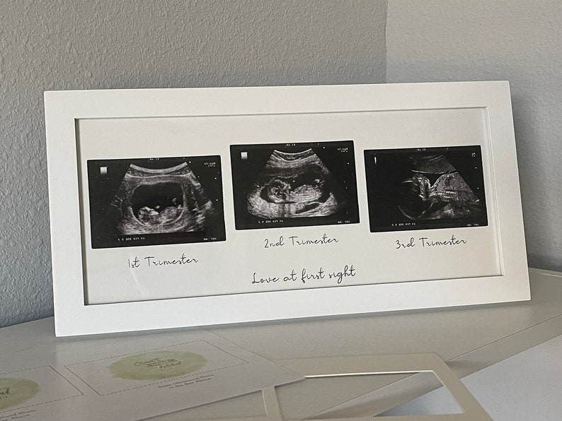 Baby Sonogram Picture Frame With Countdown Calendar. Sonogram Picture ...