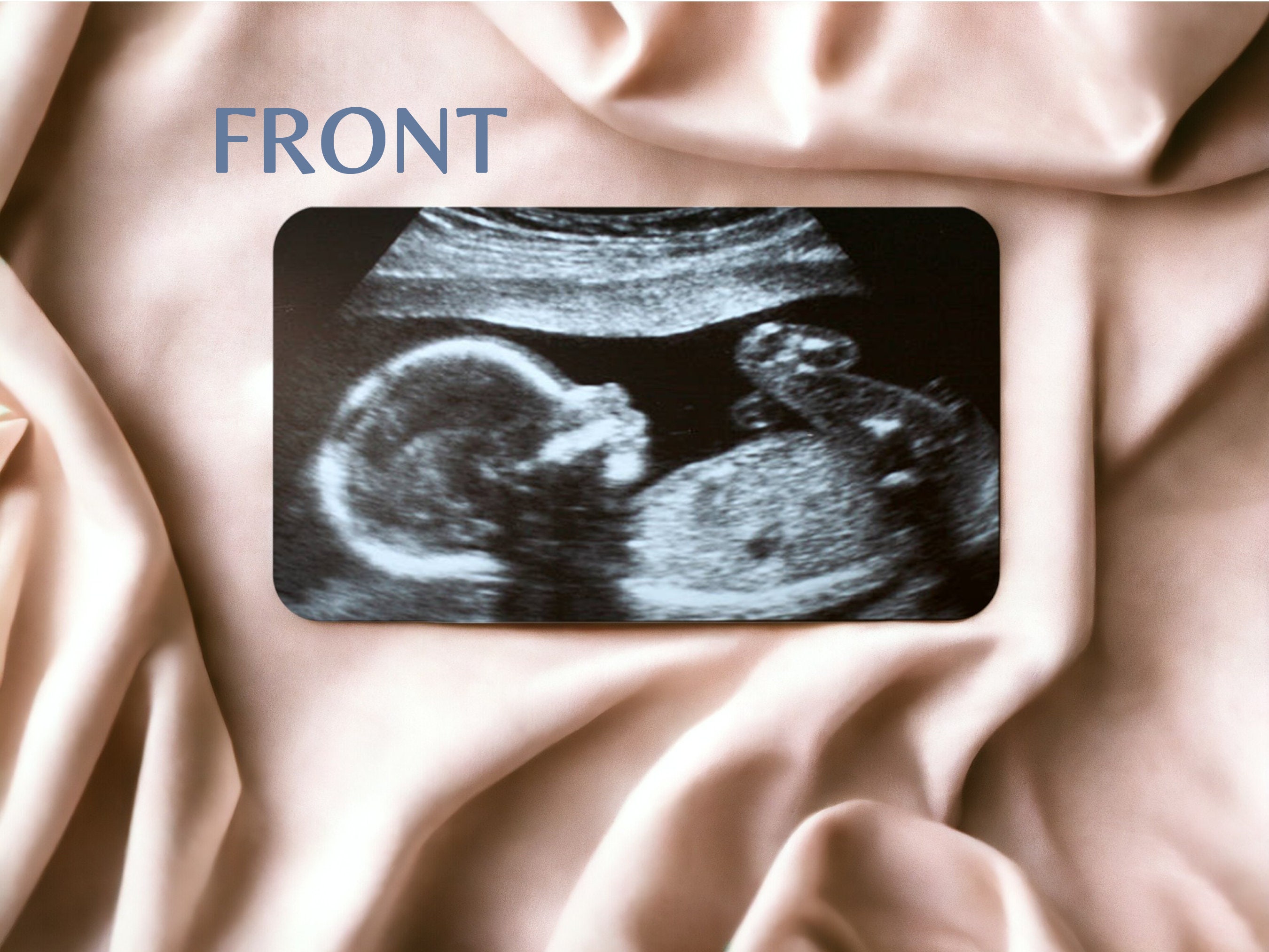 Baby Scan Wallet Card, Pregnancy Scan Metal Keepsake, Personalised Gift ...