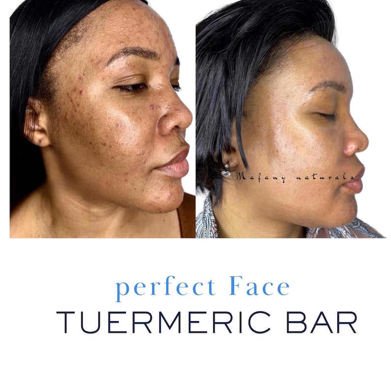 Turmeric Bar Soap, Smooth Skin Bar, Perfect Face Bar Soap 8oz - Etsy