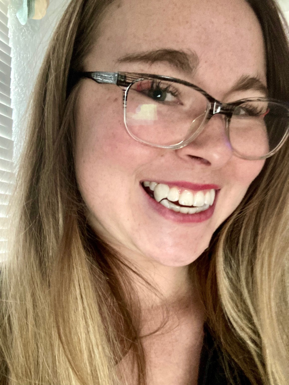 DIY Werewolf Fangs: Custom Fit Fang Set - Etsy