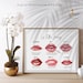 Lip Filler Journey Poster: Aesthetics Clinic Decor (printable Art) - Etsy