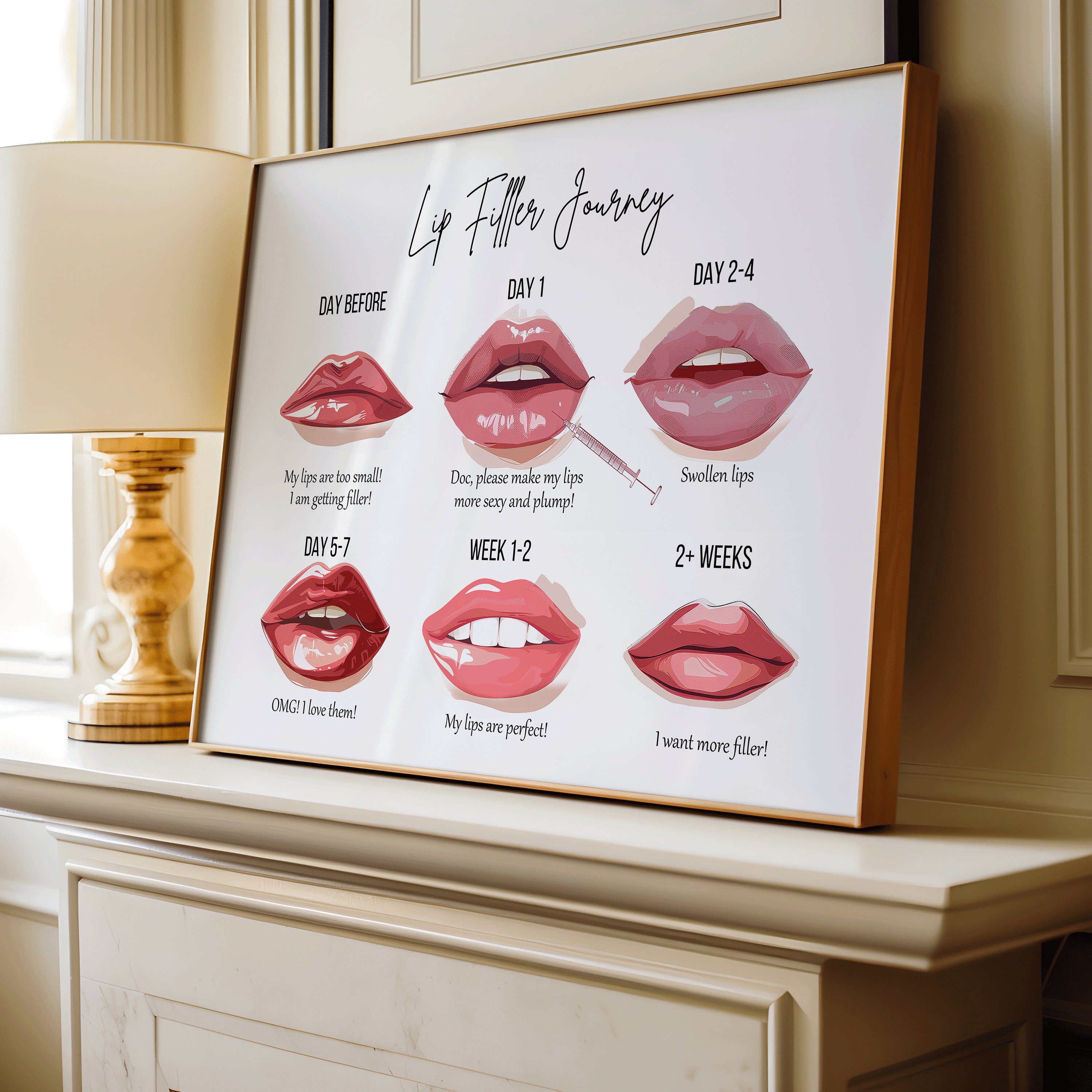 Lip Filler Journey Poster, Aesthetics Aftercare Poster, Lip Filler ...