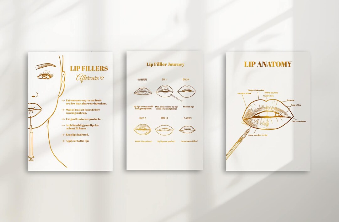Lip Filler Poster Set: Aftercare, Journey, Anatomy (digital Download ...