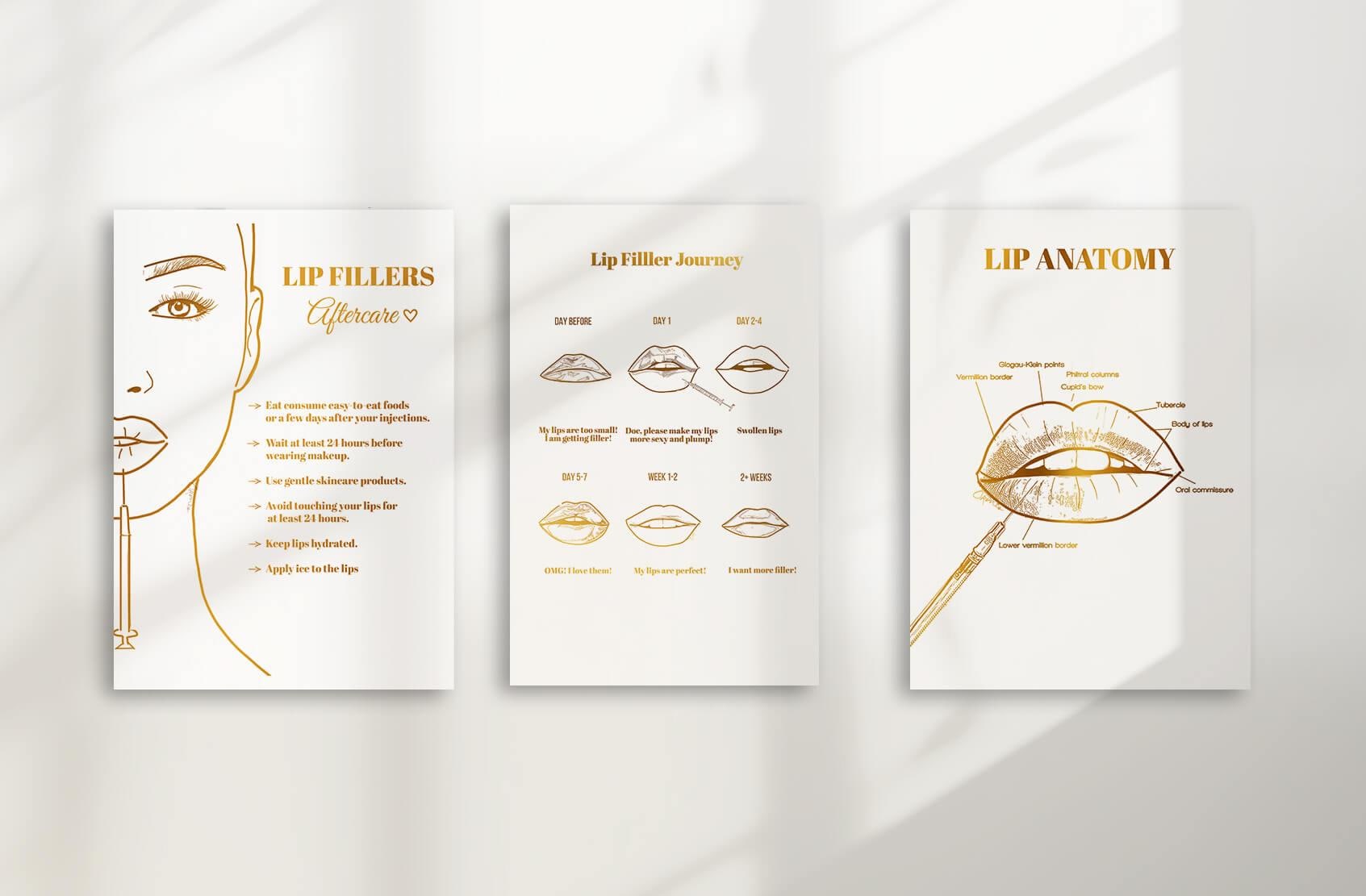 Lip Filler Poster Set: Aftercare, Journey, Anatomy (digital Download ...