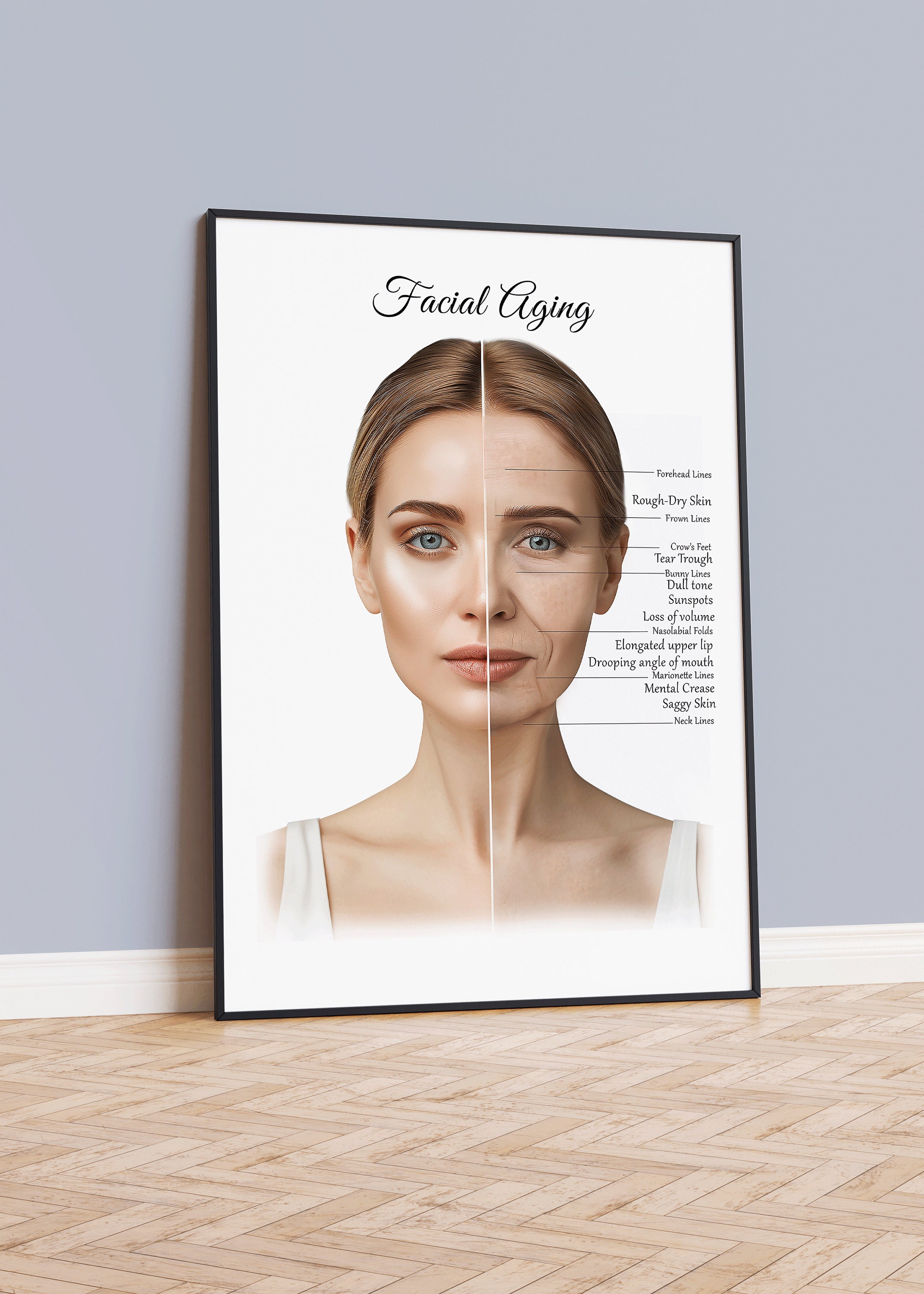 Facial Aging Poster, Skin Aging Art, Esthetician Decor, Med Spa Art ...