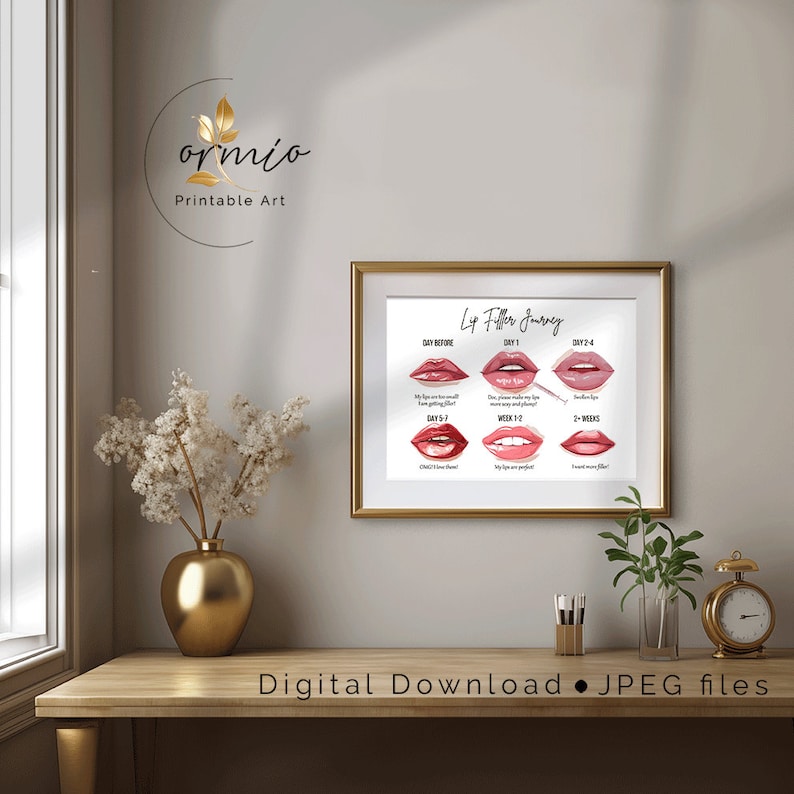 Lip Filler Journey Poster: Aesthetics Clinic Decor (printable Art) - Etsy