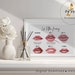 Lip Filler Journey Poster: Aesthetics Clinic Decor (printable Art) - Etsy