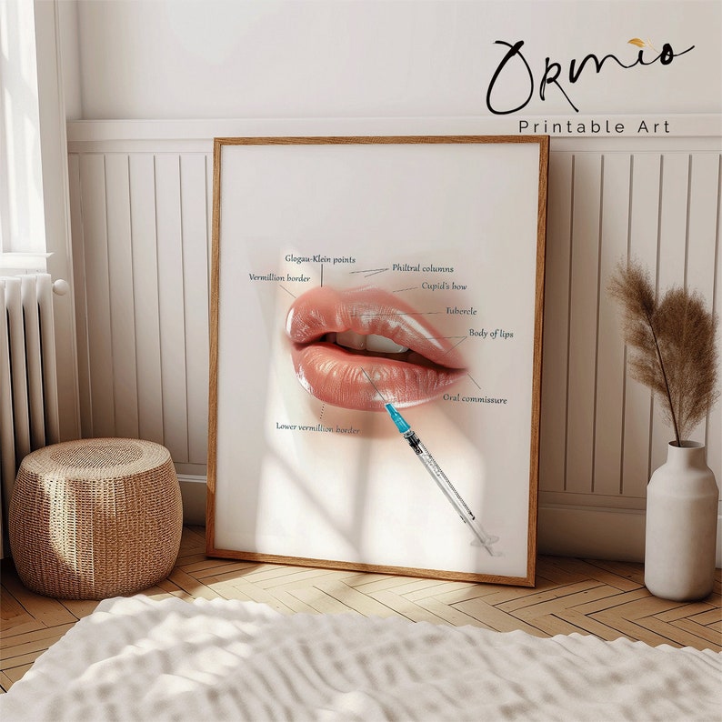 Lip Anatomy Art Print: Lip Filler Injection Poster (digital Download ...