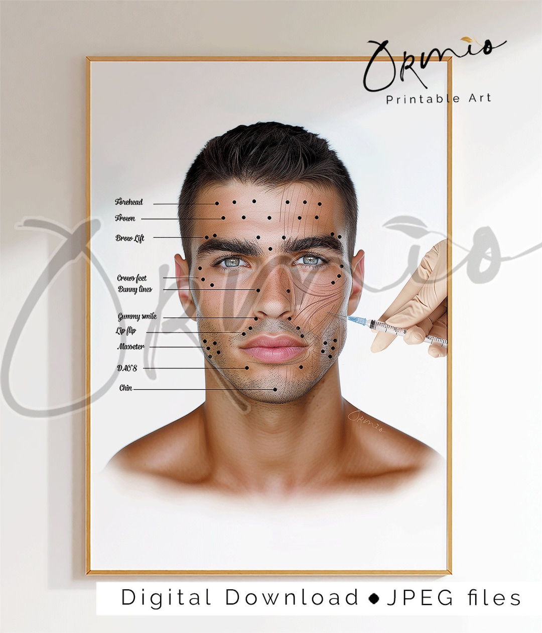 Botox Injection Points Poster: Medical Esthetician Art (digital ...