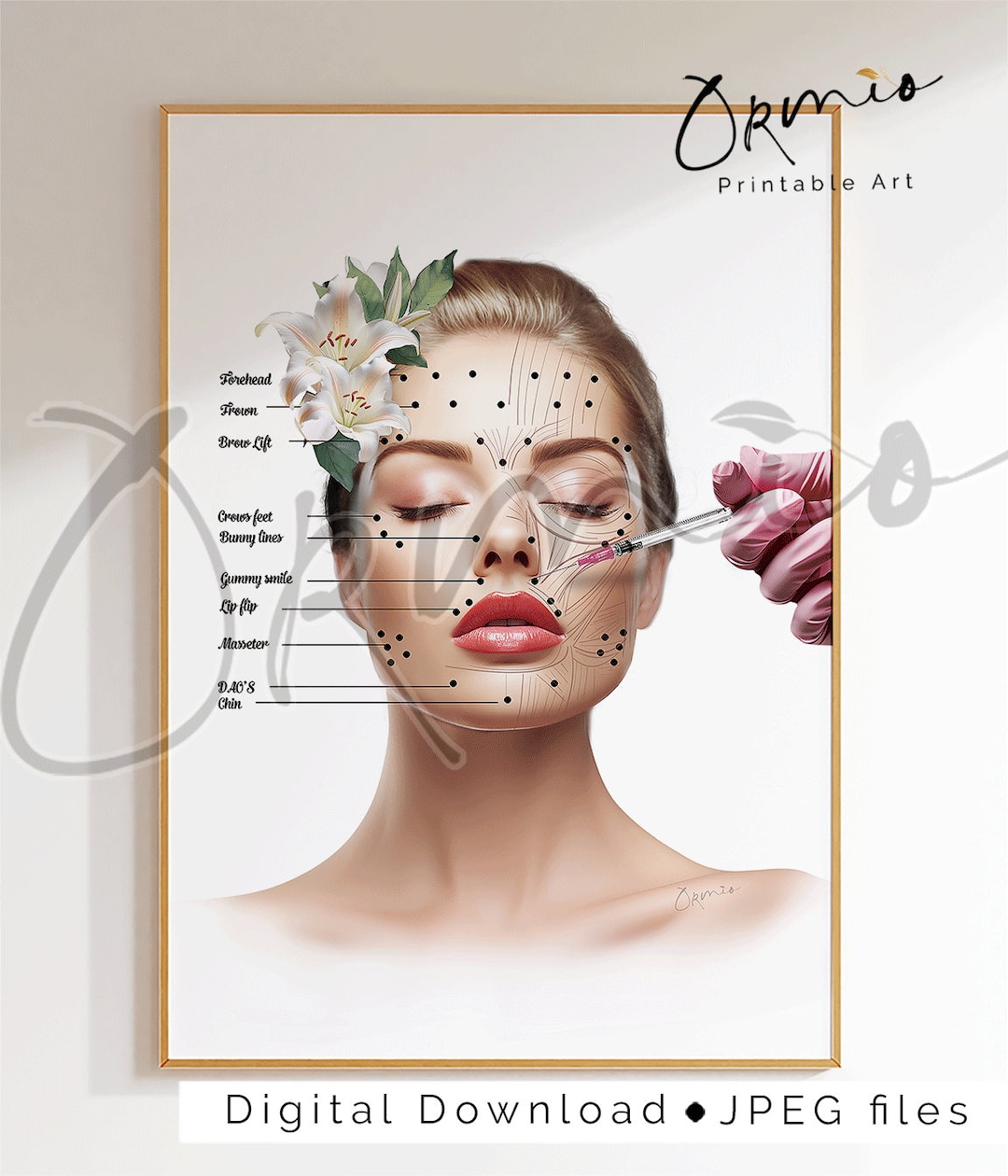 Botox Injection Points Art: Med Spa Decor Printable (digital Download ...