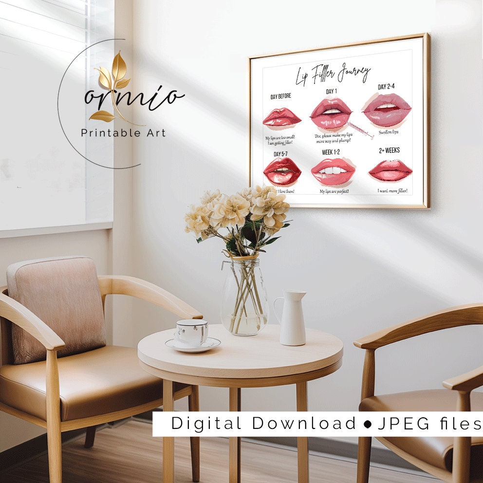 Lip Filler Journey Poster: Aesthetics Clinic Decor (printable Art) - Etsy