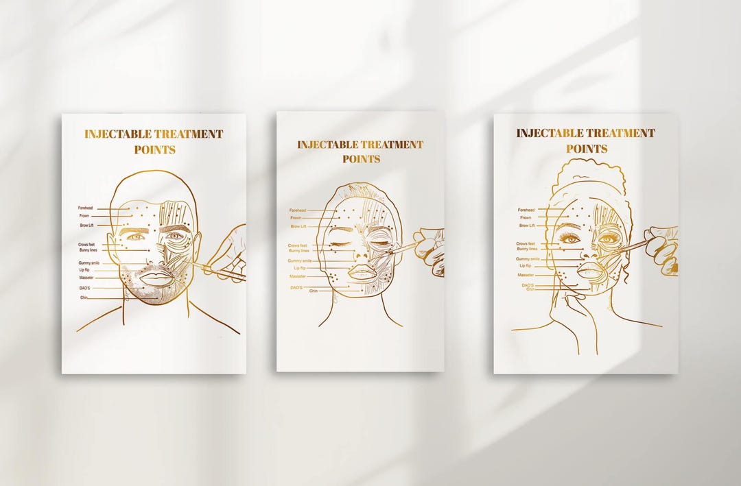 Injectable Treatment Points Poster Set | Botox Injection Sites for ...