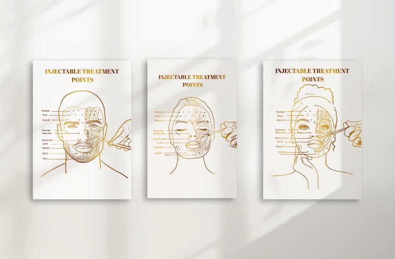 Injectable Treatment Points Poster Set Botox Injection Sites for ...