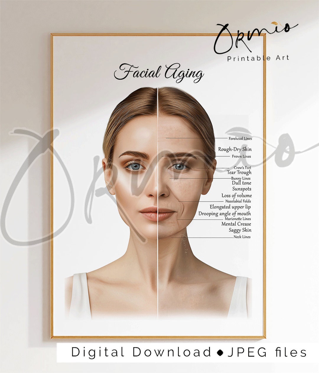 Facial Aging Poster, Skin Aging Art, Esthetician Decor, Med Spa Art ...