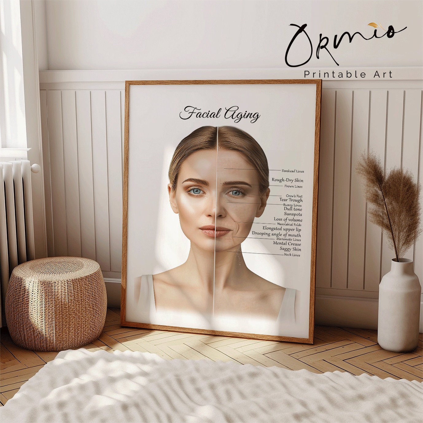 Facial Aging Poster, Skin Aging Art, Esthetician Decor, Med Spa Art ...