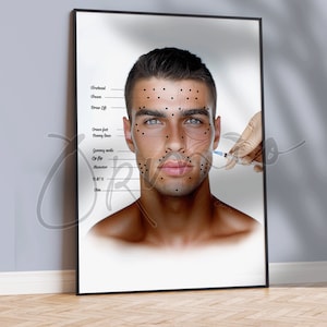 Botox Injection Points Poster: Medical Esthetician Art (digital ...