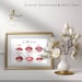 Lip Filler Journey Poster: Aesthetics Clinic Decor (printable Art) - Etsy