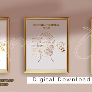 Injectable Treatment Points Poster Set | Botox Injection Sites for ...