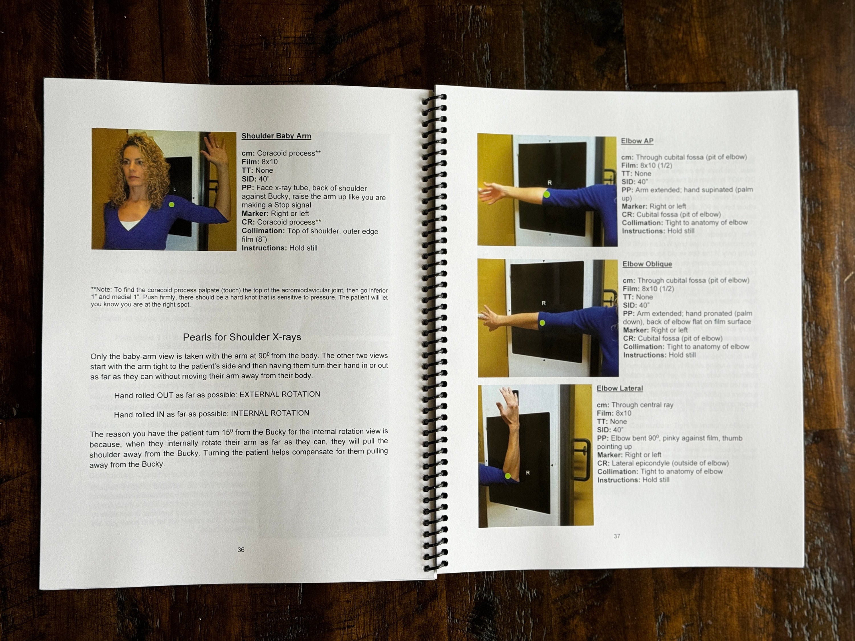 Chiropractic X-ray Positioning, Practical Tips and Shortcuts for Taking ...