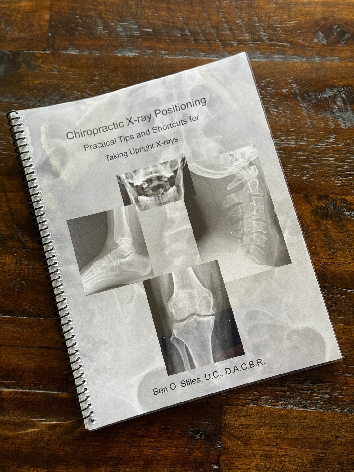 Chiropractic X-ray Positioning, Practical Tips and Shortcuts for Taking ...