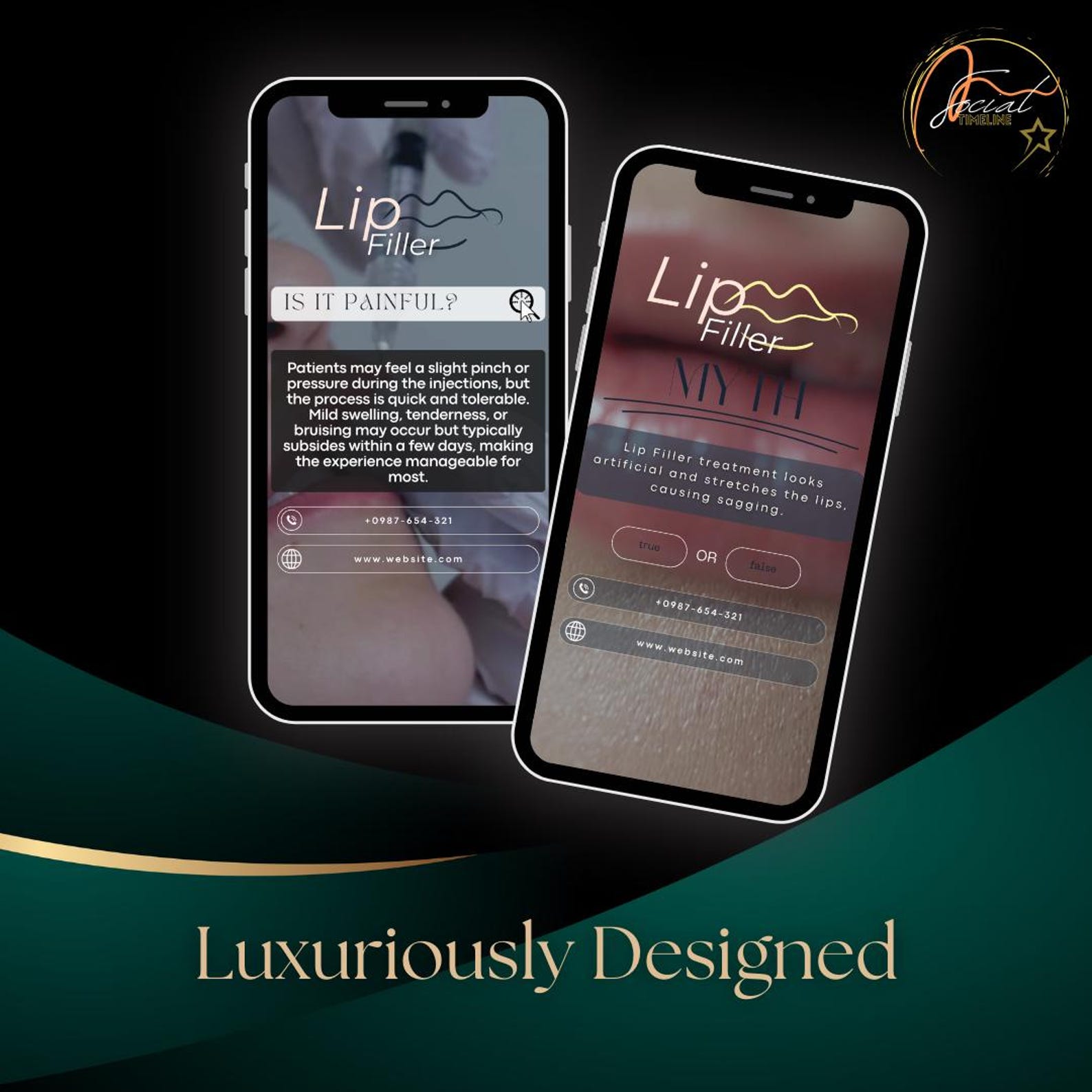 Lip Filler Instagram Reels Templates: Medspa Marketing (canva) - Etsy