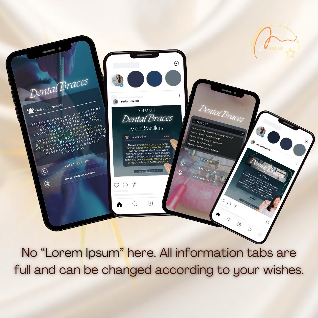 Dental Braces Instagram Templates: Orthodontist Posts, Reels, Stories ...