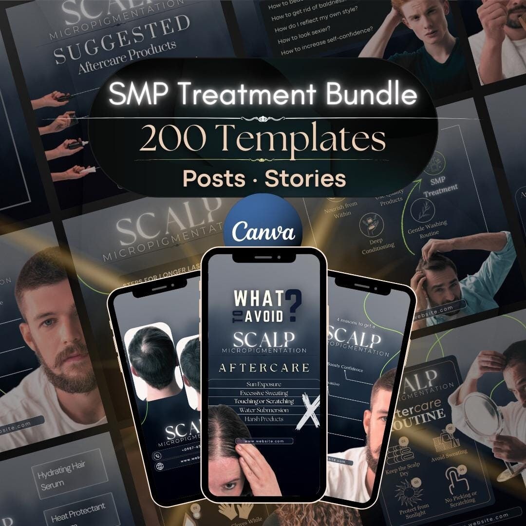200 Scalp Micropigmentation Social Media Templates, SMP PMU Templates ...